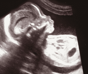 9 Uplifting Christian Testimonies To Encourage Your Faith | Think About ...