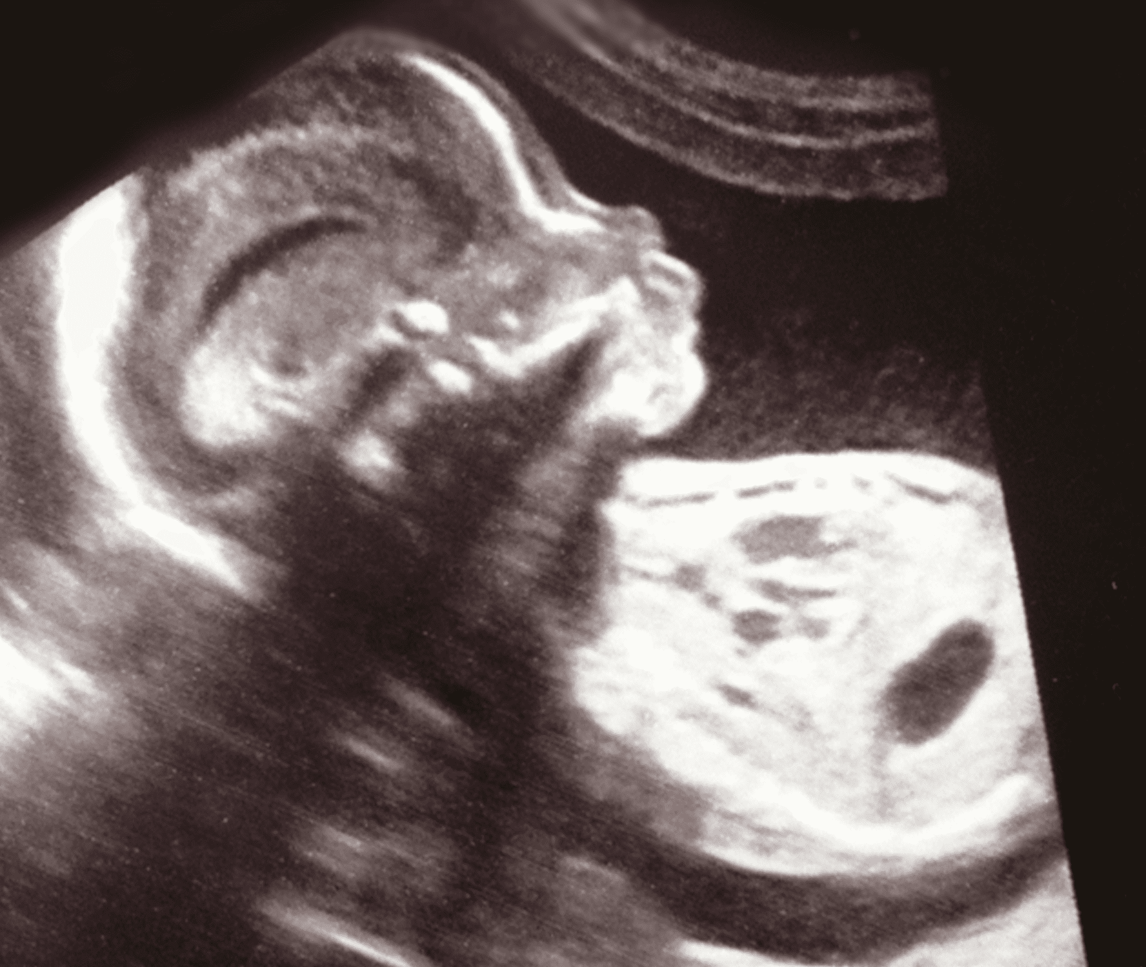 9 Uplifting Christian Testimonies To Encourage Your Faith | Think About ...